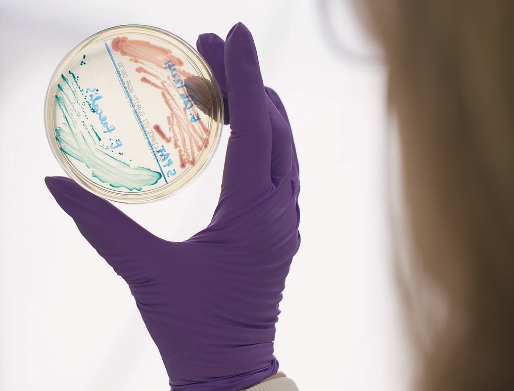 Gut bacteria ‘fingerprint’ predicts radiotherapy side effects | TRM ...