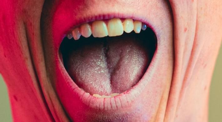 Mouth cancer: Causes, types, and treatments | The Royal Marsden