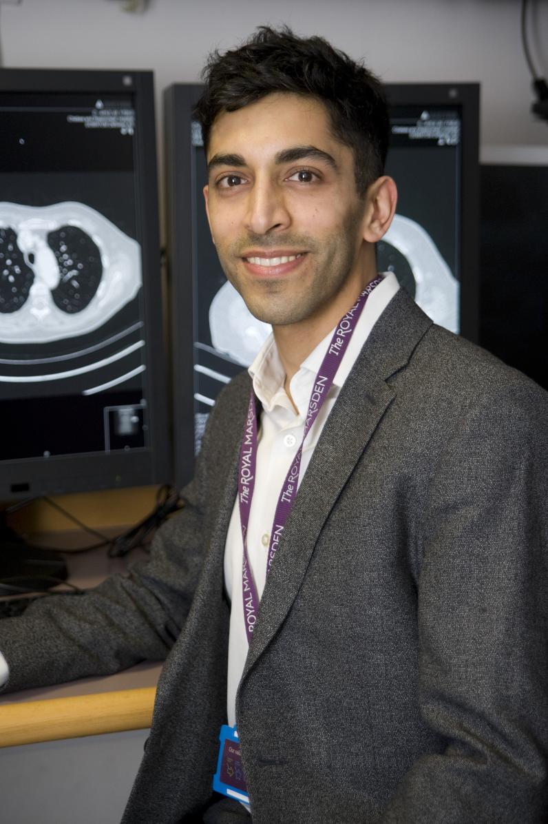 Study suggests AI can predict risk of lung cancer returning using CT ...